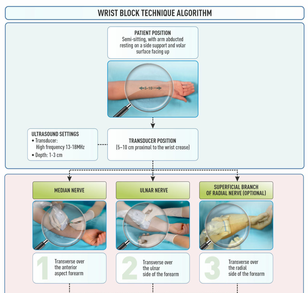 Wrist Block Technique Algorithm – NYSORA e-Learning System