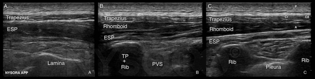 Technique - NYSORA e-Learning System