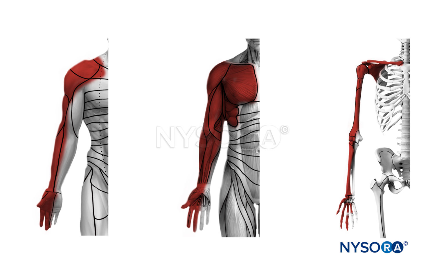 Cme Course Upper Extremity Blocks Part I Nysora E Learning System