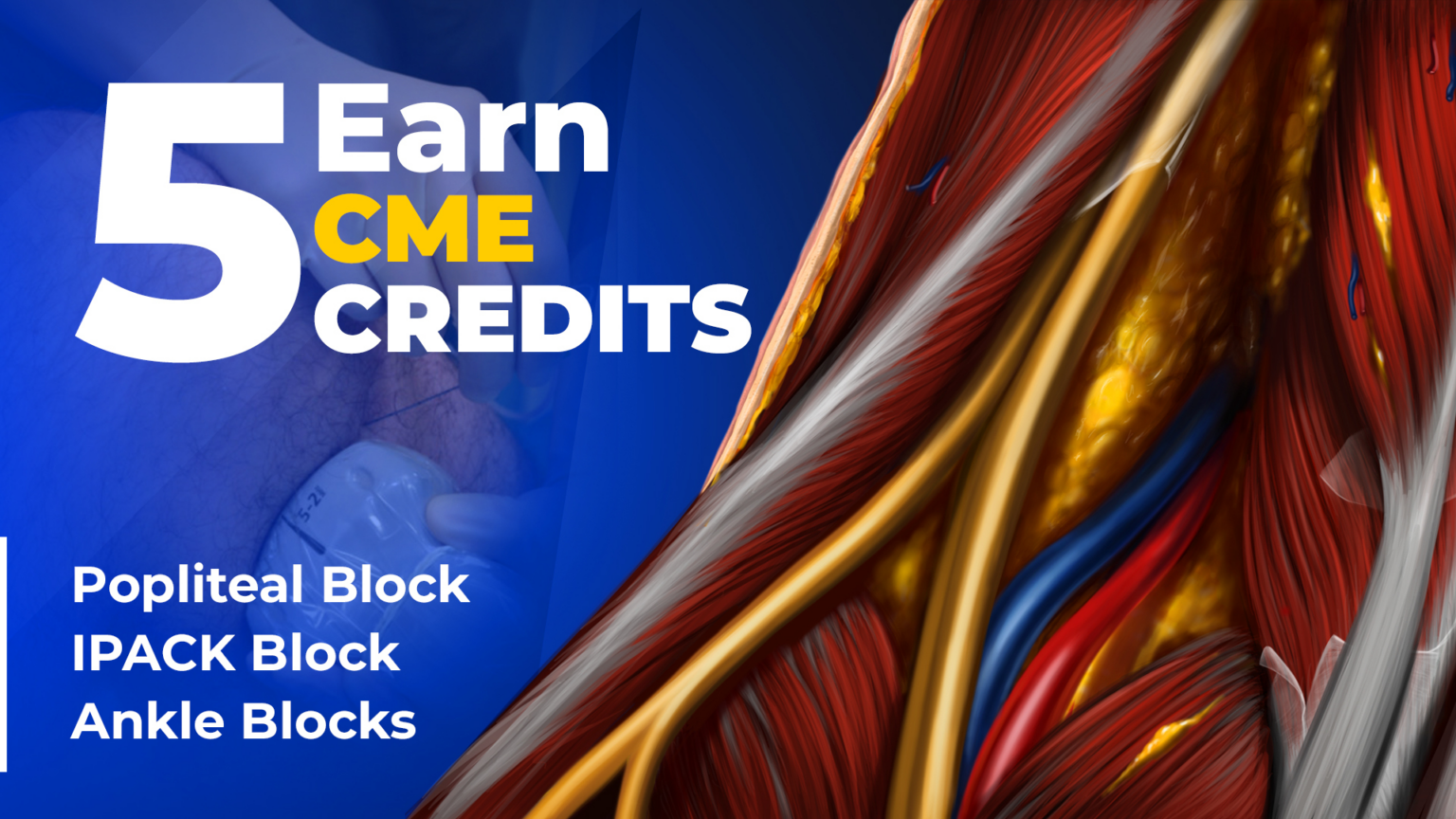 CME COURSE - Lower Extremity Blocks Part II - NYSORA 360