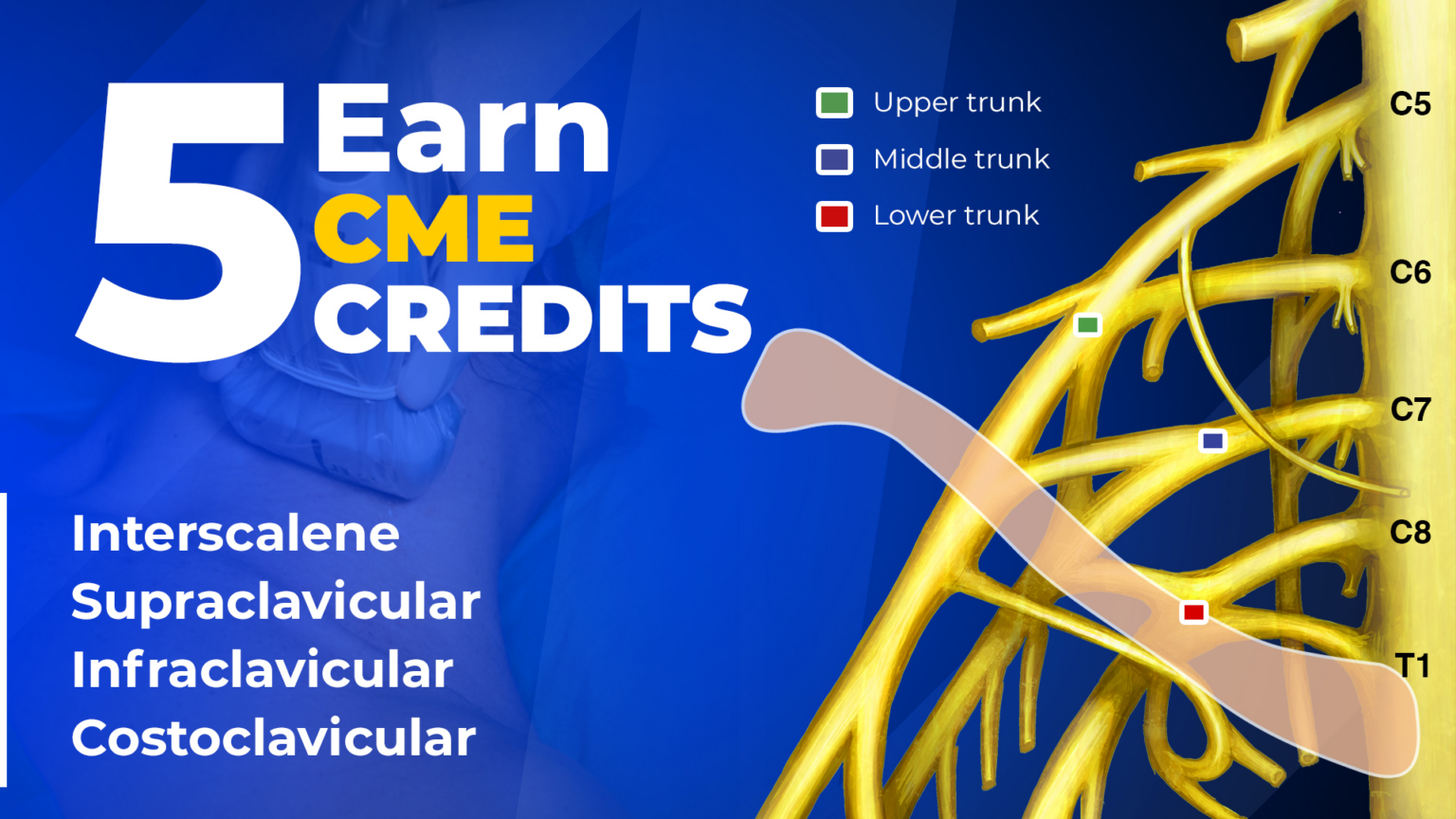 CME COURSE - Upper Extremity Blocks Part I - NYSORA 360