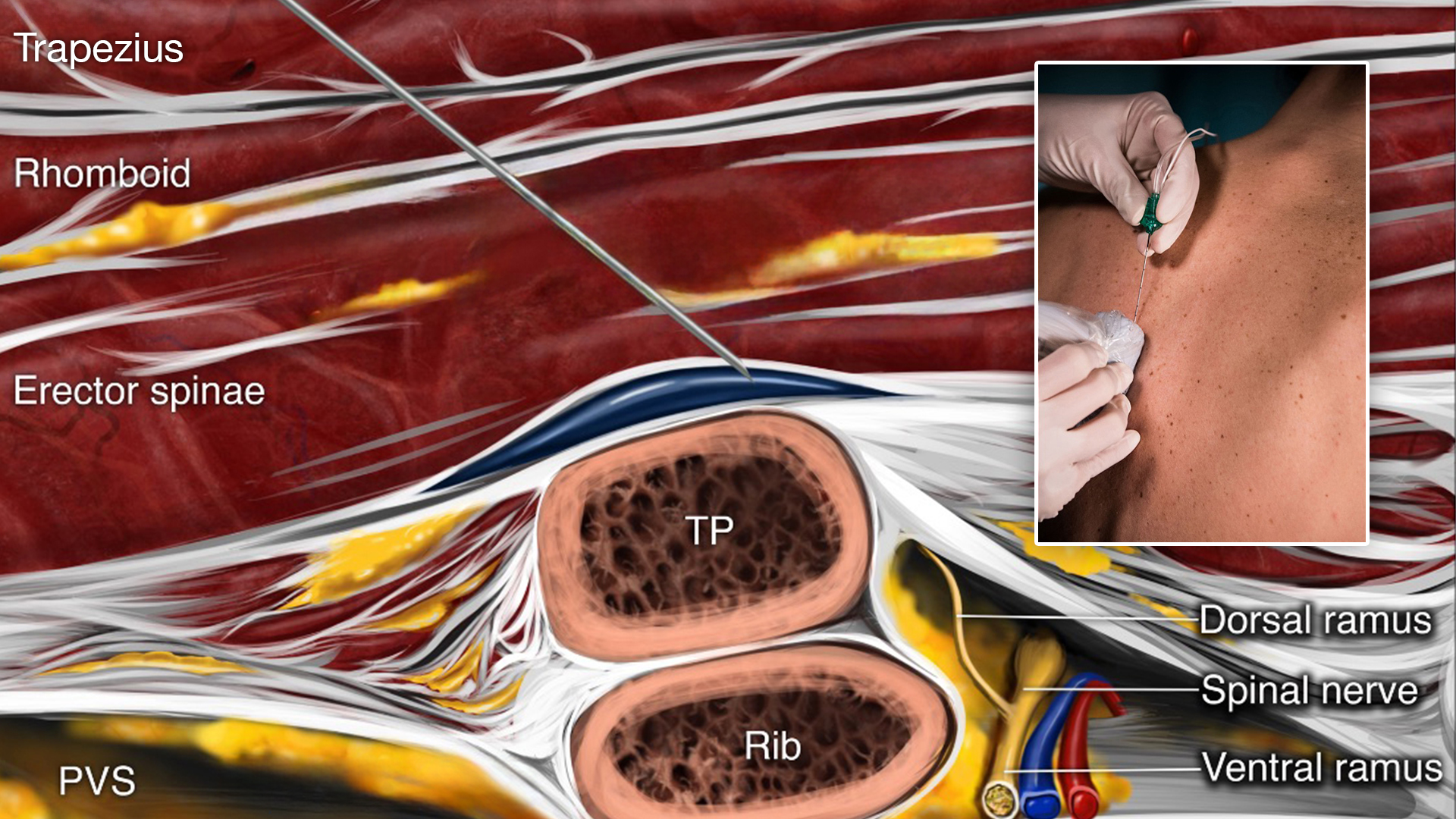 Activity Feed - NYSORA Learning System